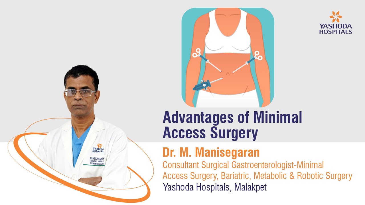 Advantages of Minimal Access Surgery | Yashoda Hospitals Hyderabad ...