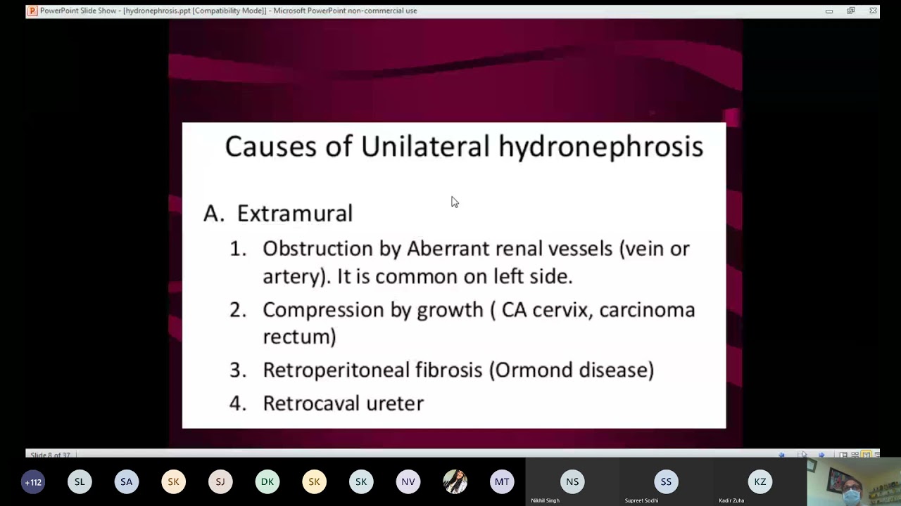 Surgery Hydronephrosis Dr. R M Kulkarni - YouTube