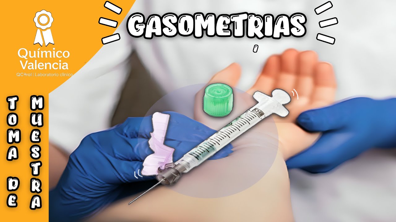 ¿Cómo se toma la muestra de gasometría arterial? PUNCIÓN ARTERIAL - YouTube