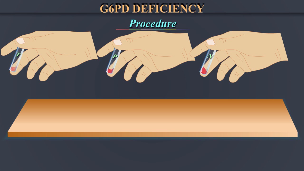 G6PD Deficiency - YouTube