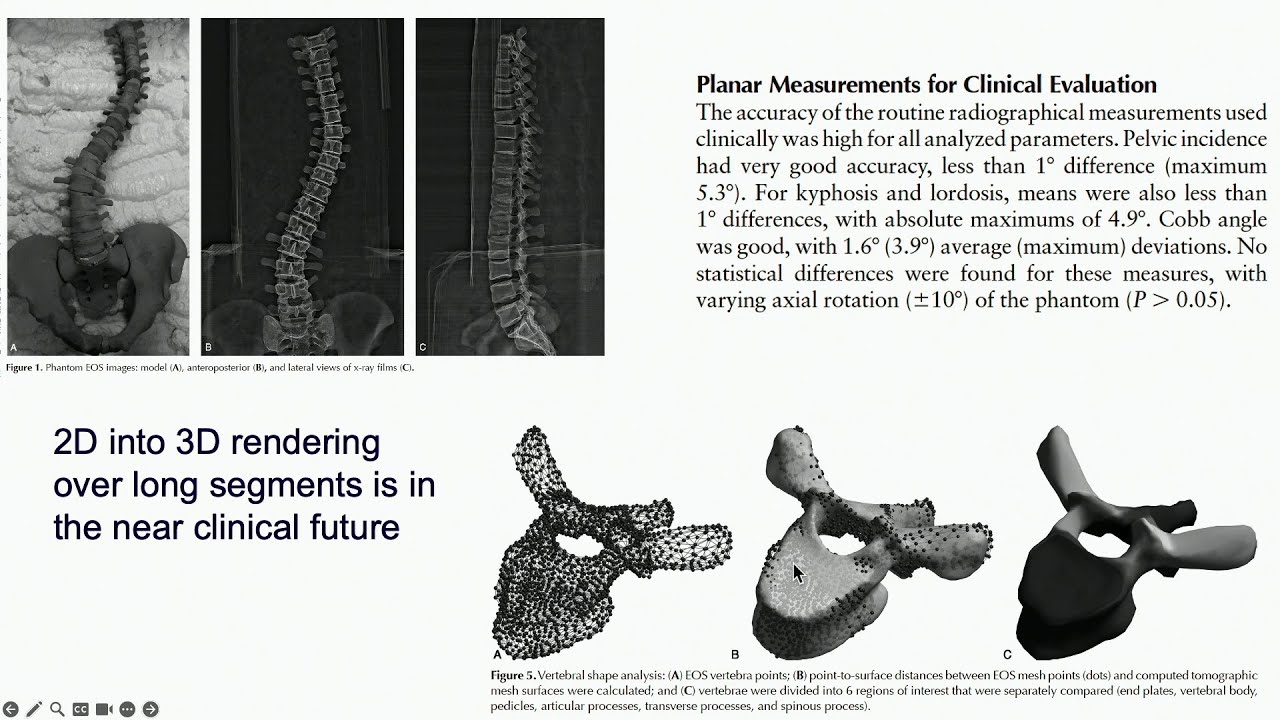 Intraoperative Imaging/Assessment in Complex Spine Surgery - Patrick ...