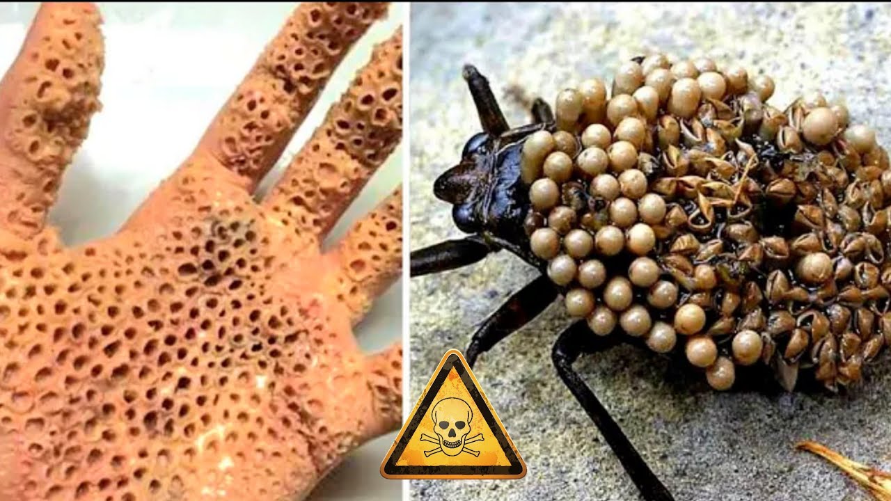 🔴CUIDADO! INSETOS mais MORTAIS do mundo | Mundo Extra | Curiosidades ...