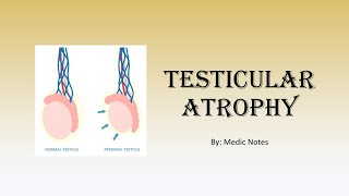 Causes Of Testicular Atrophy