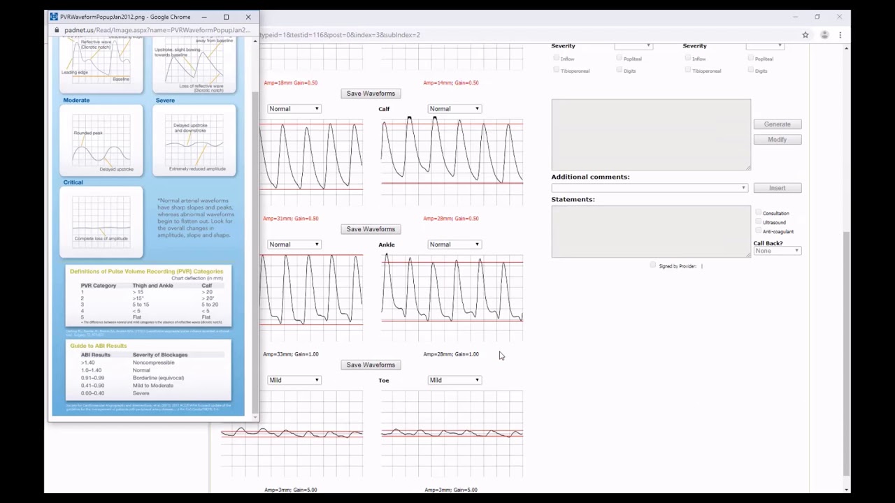 How to interpret a PADnet study in the PADnet.us collaborative care ...