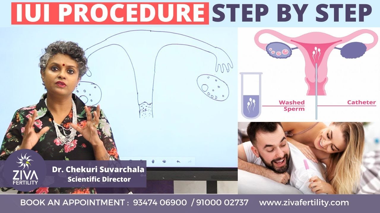 IUI procedure : Step By Step || Best Fertility Treatment || Dr C ...