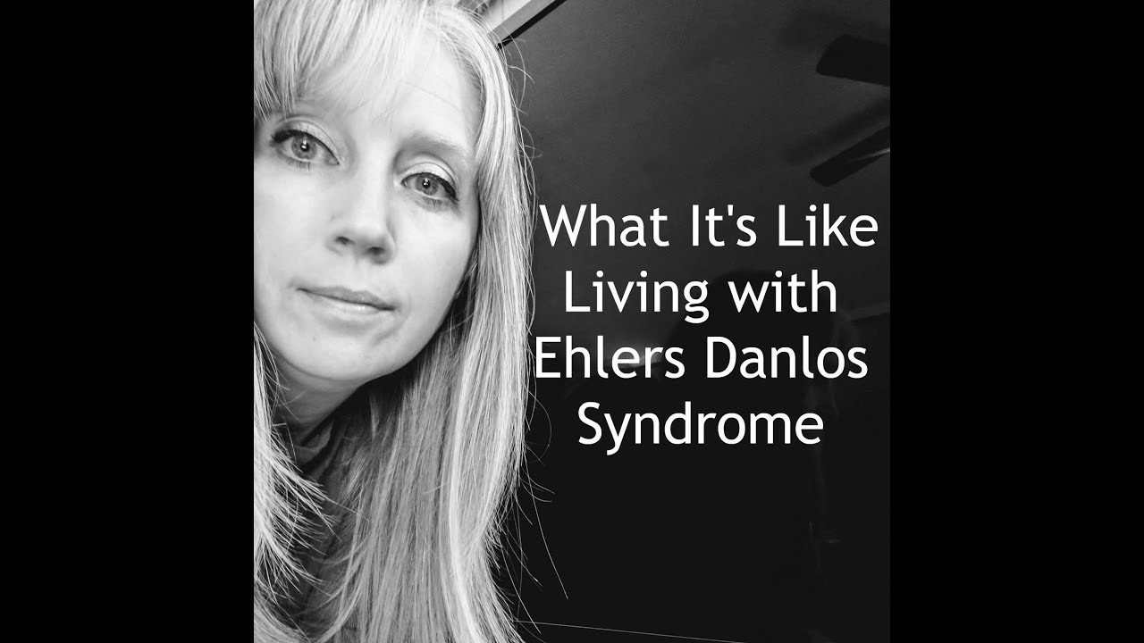 What It's Like Living with Ehlers Danlos Syndrome (EDS) and How I Get ...