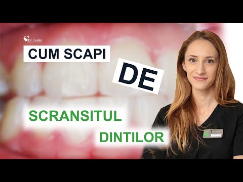 5 cauze pentru bruxism. De ce iti scrasnesc dintii in timpul somnului – Clinicile Dentare Dr. Leahu