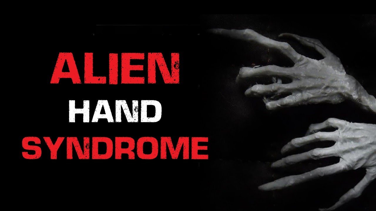 "Alien Hand Syndrome" Creepypasta - Scary Story - YouTube