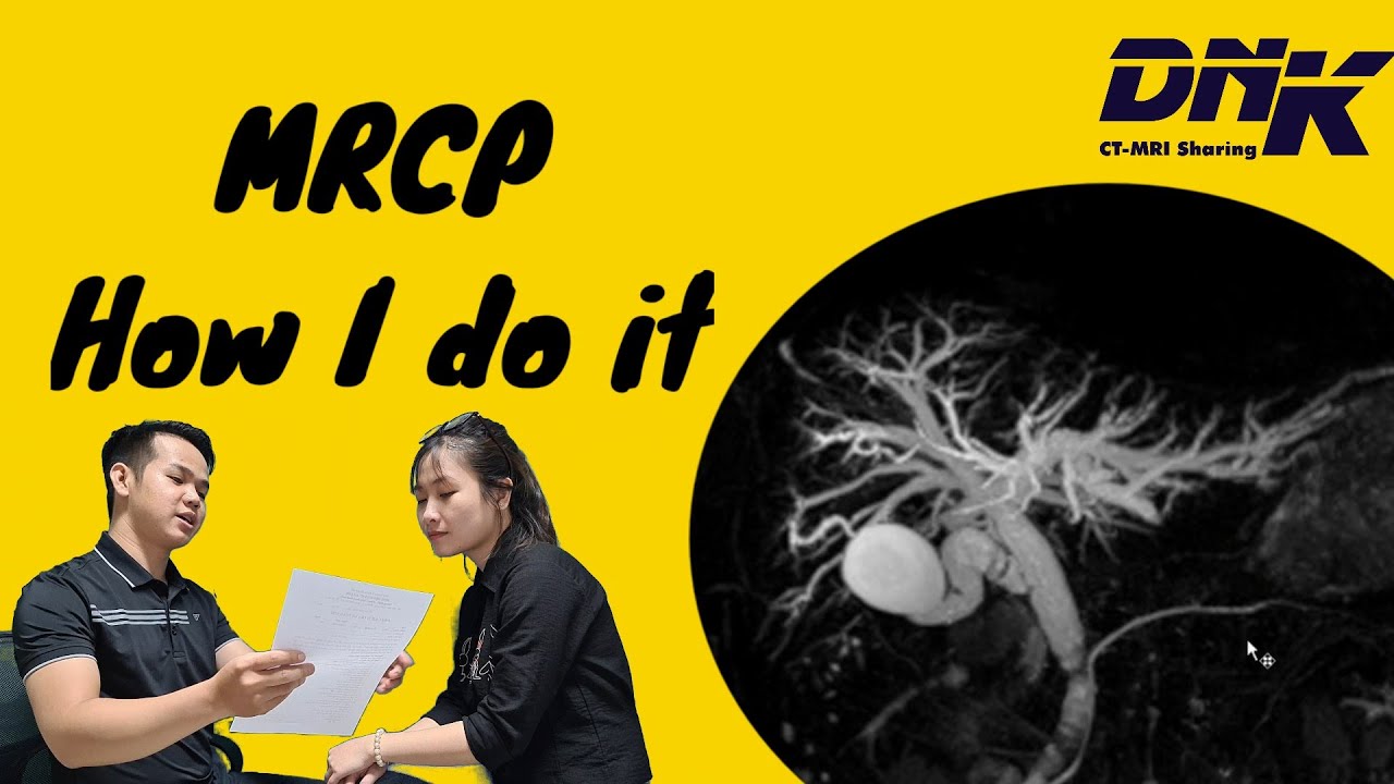 MRCP How I do it- cách chụp MRCP cơ bản và nâng cao. - YouTube