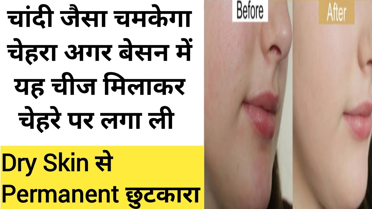 Dry skin Face Pack सूखी व् खुश्क त्वचा के लिए Permanent इलाज# ...