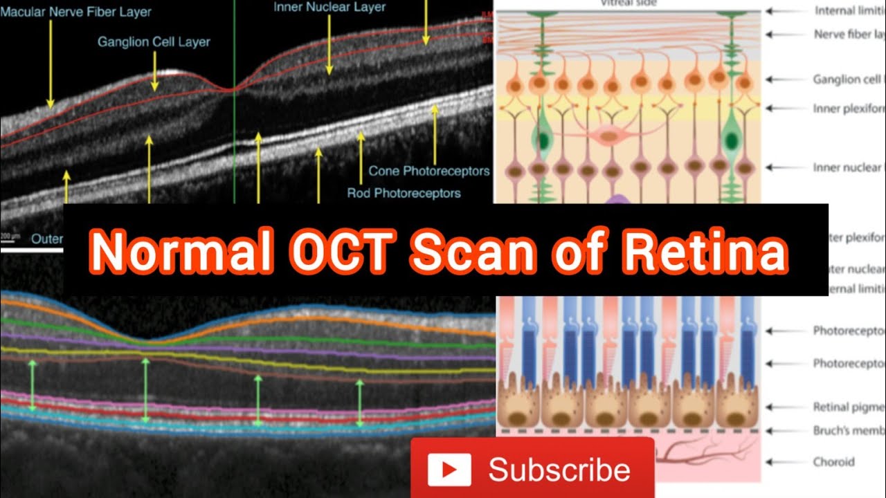 Normal Retinal Structures in OCT Scan | Optical Coherence Tomography ...