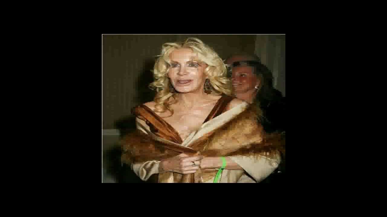 Bad Botox Failures (HD 720p) - YouTube