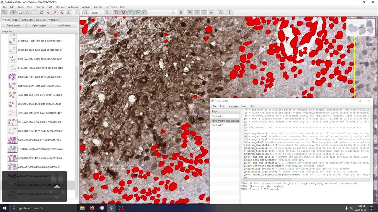 HDAB Cell Detection using StarDist in QuPath - YouTube