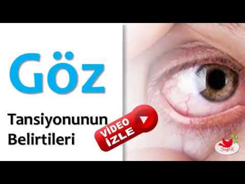 Göz Tansiyonunun Belirtileri ?