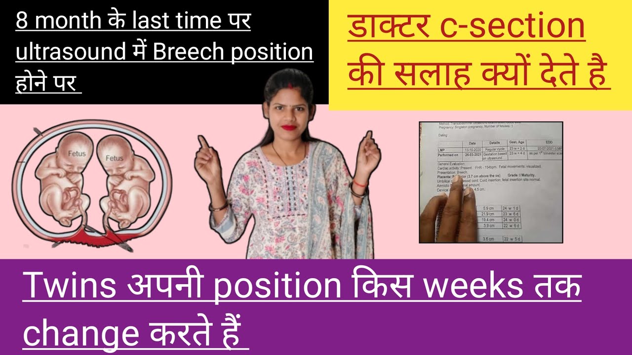 Twins pregnancy ke last time par breech position hone par doctor aapko ...