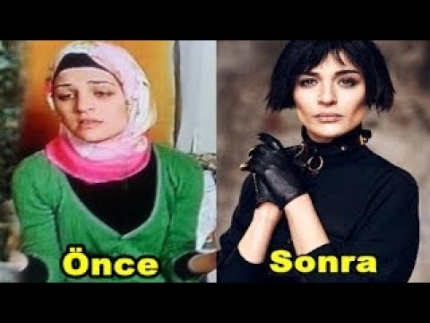 Anne Dizisi Oyuncuları Öncesi ve Sonrası HD