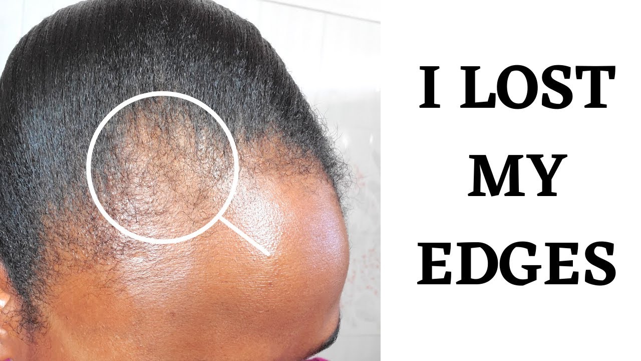 RELAXED HAIR Post Relaxer Routine to GROW MY EDGES with BIOTIN HAIR ...