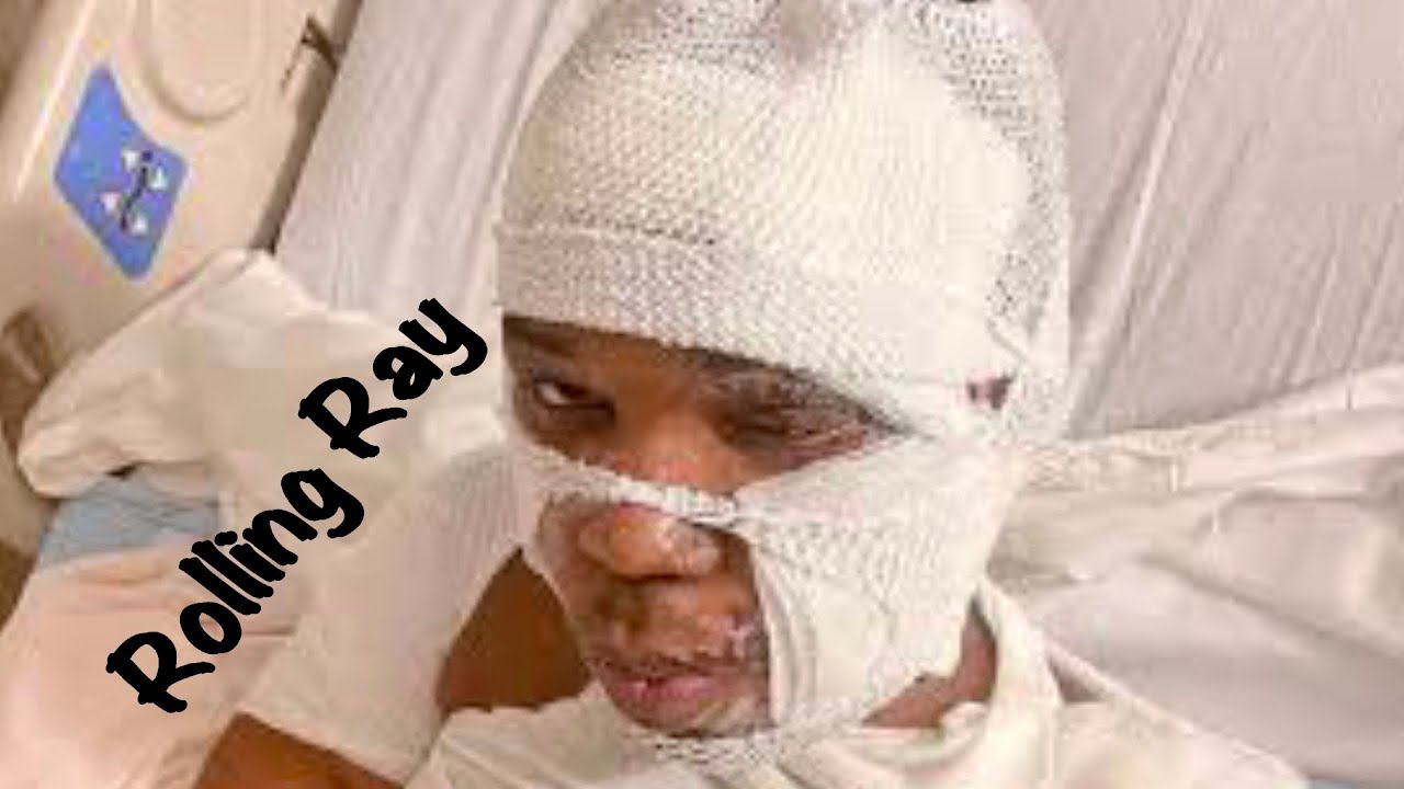 Rolling Ray Details His Accident - YouTube