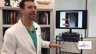 Dr. Kyle Lindow Explains 3-D Bunion Procedure LAPIPLASTY | Doovi