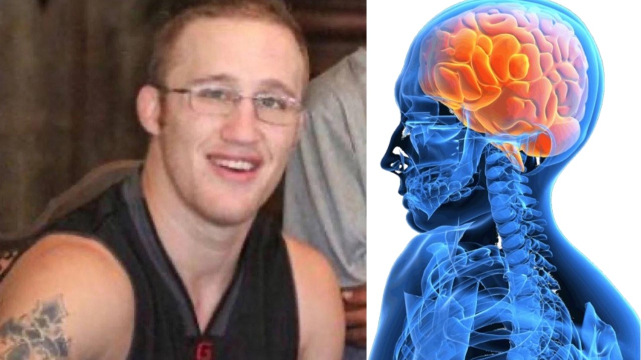 UFC Fighters with the worst brain damage - YouTube