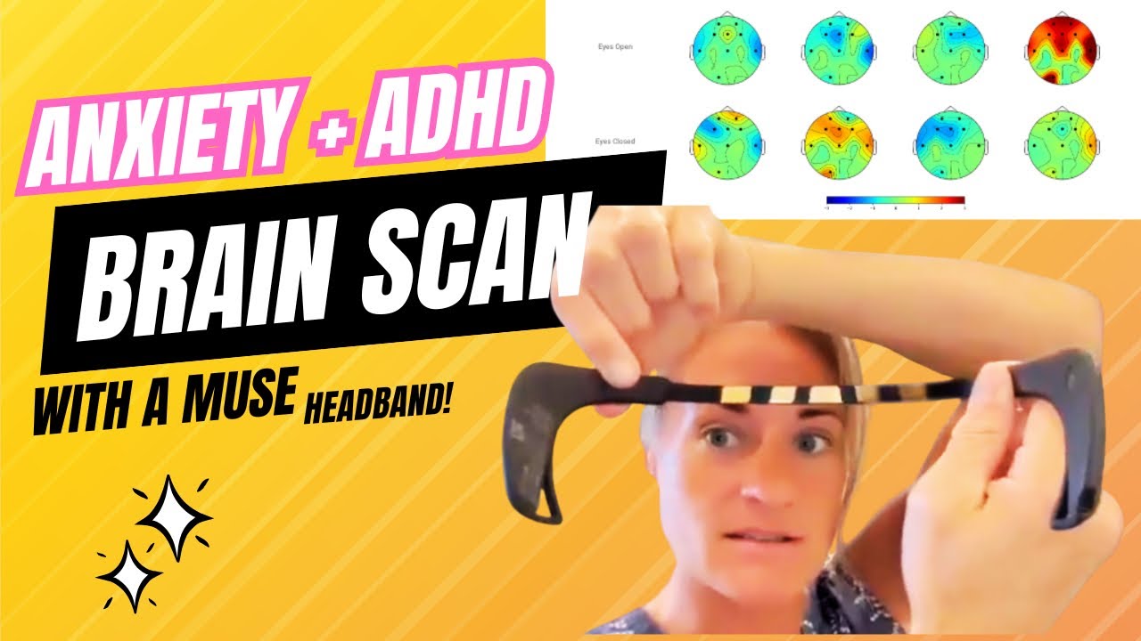 Brain Scan Review: 29yr old with ADHD & Anxiety - YouTube