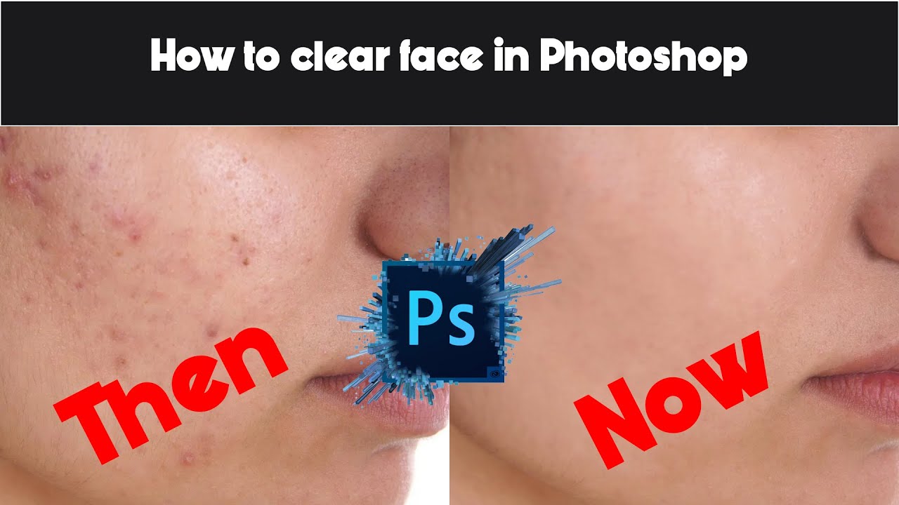how to clean face in photoshop.... - YouTube