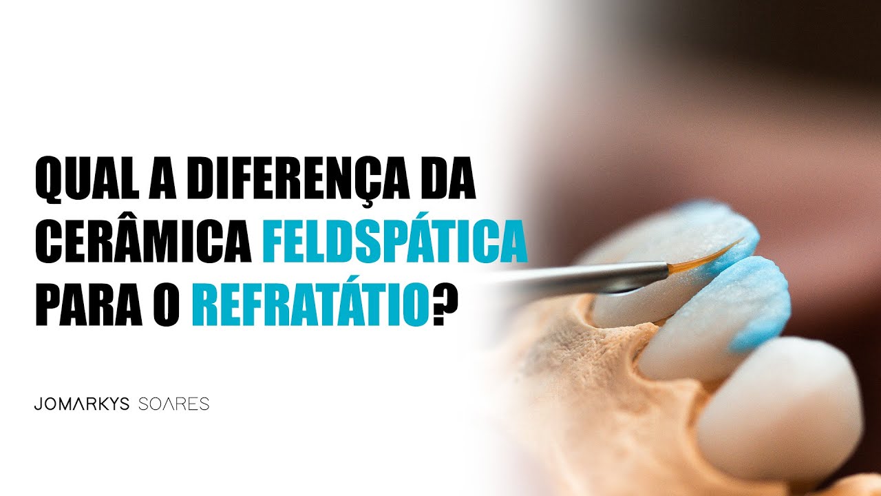 Qual a diferença da cerâmica feldspáticas para o refratário? - YouTube