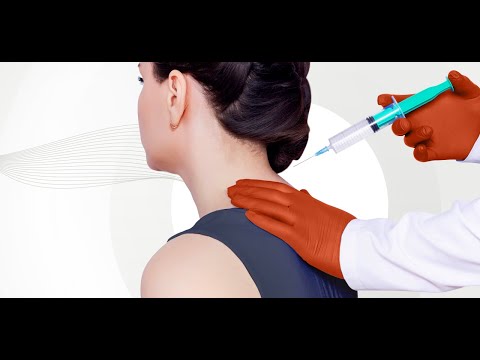 Cervical Epidural Steroid Injection: Success Rates and Risk