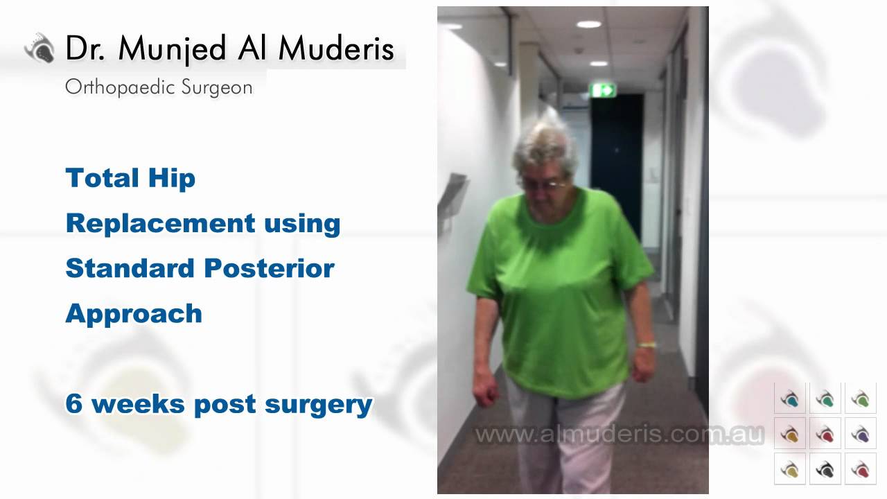 Total Hip Replacement (Posterior Approach) - 6 weeks post surgery - YouTube