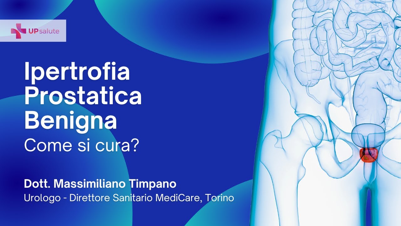 Ipertrofia Prostatica Benigna: come si cura - Dott. Massimiliano ...