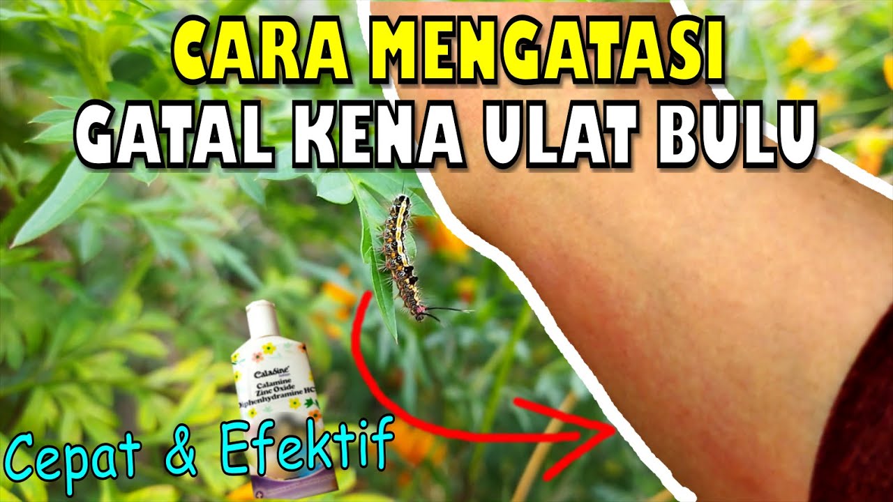 GATAL ULAT BULU, INI CARA MENGOBATI JIKA KULIT BENTOL MERAH MENYEBAR ...