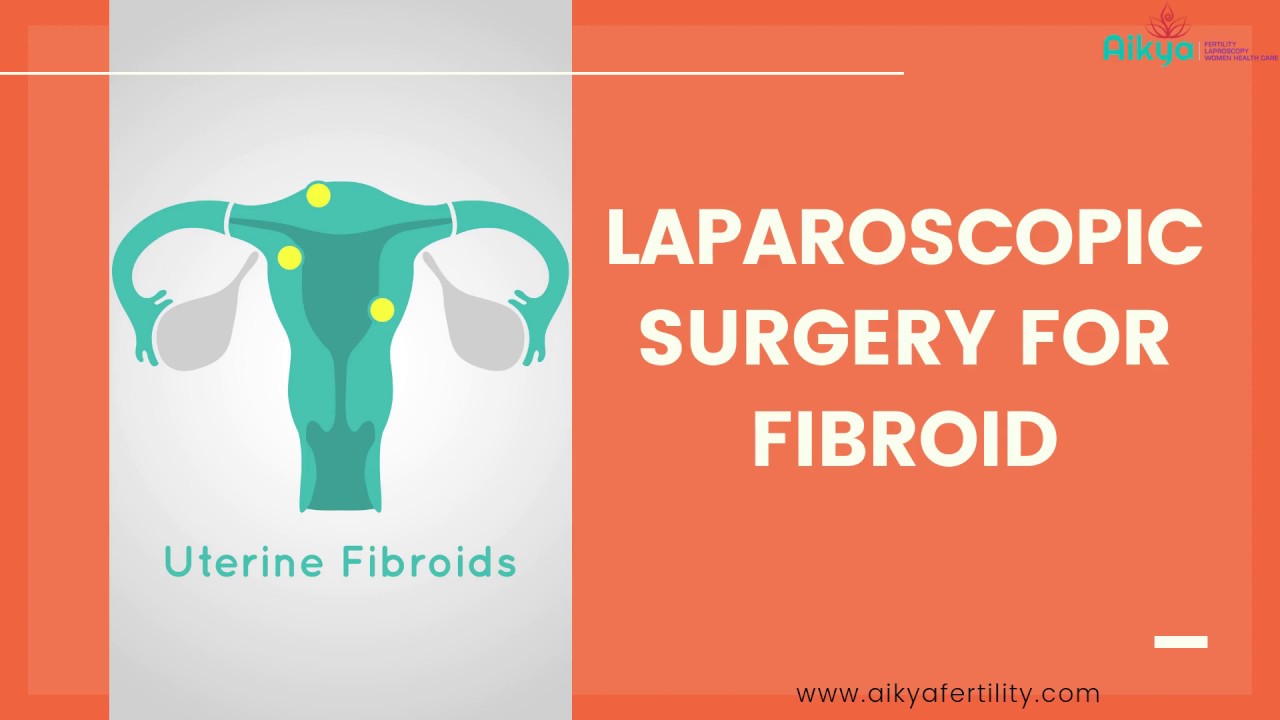 Laproscopic Surgery For Fibroid | Fibroid Treatment | Fertility ...