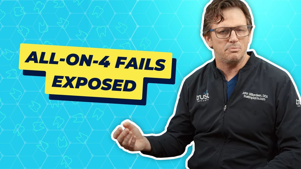 Failed "All on 4" Case: The Avoidable Dental Trauma - YouTube