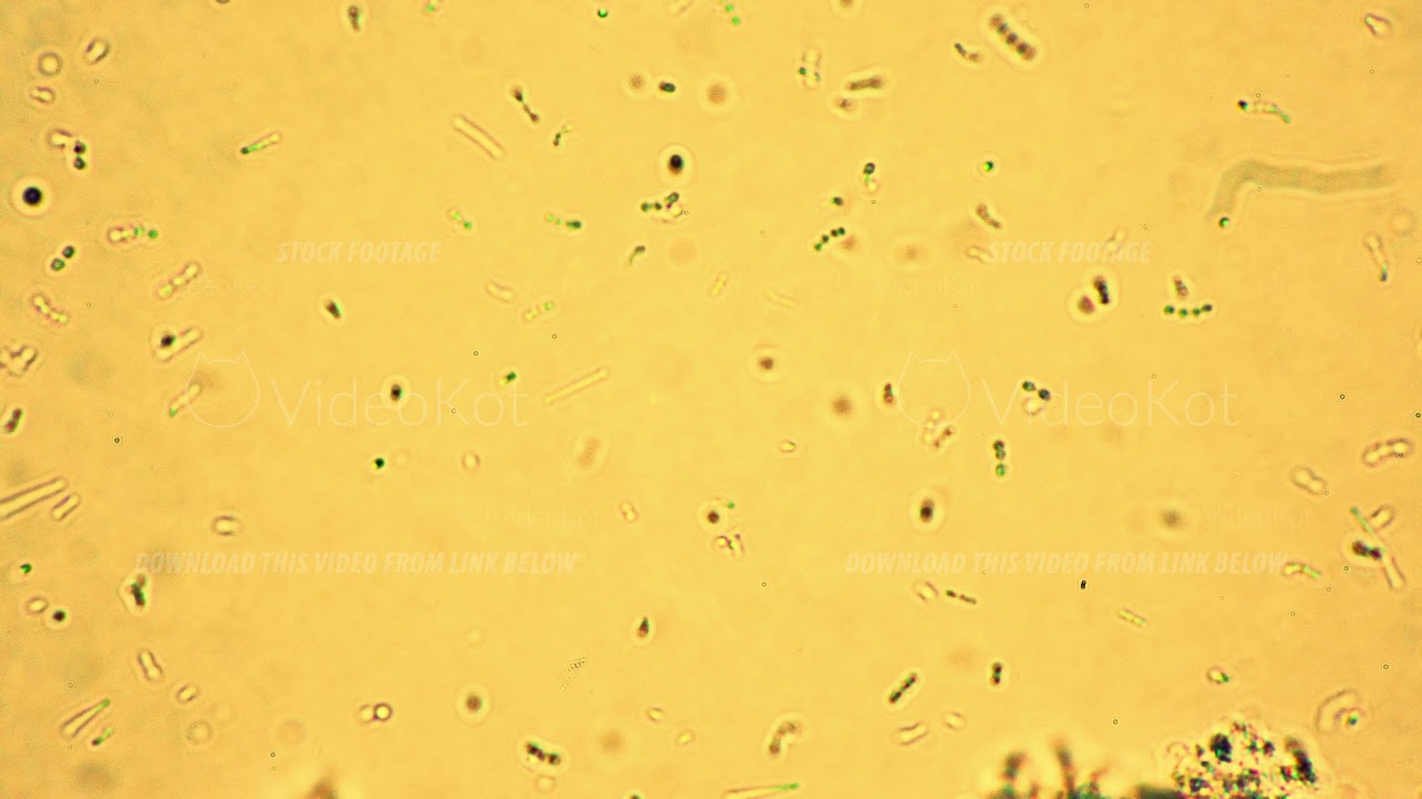 Group of little lactic acid bacteria are moving slowly under the ...