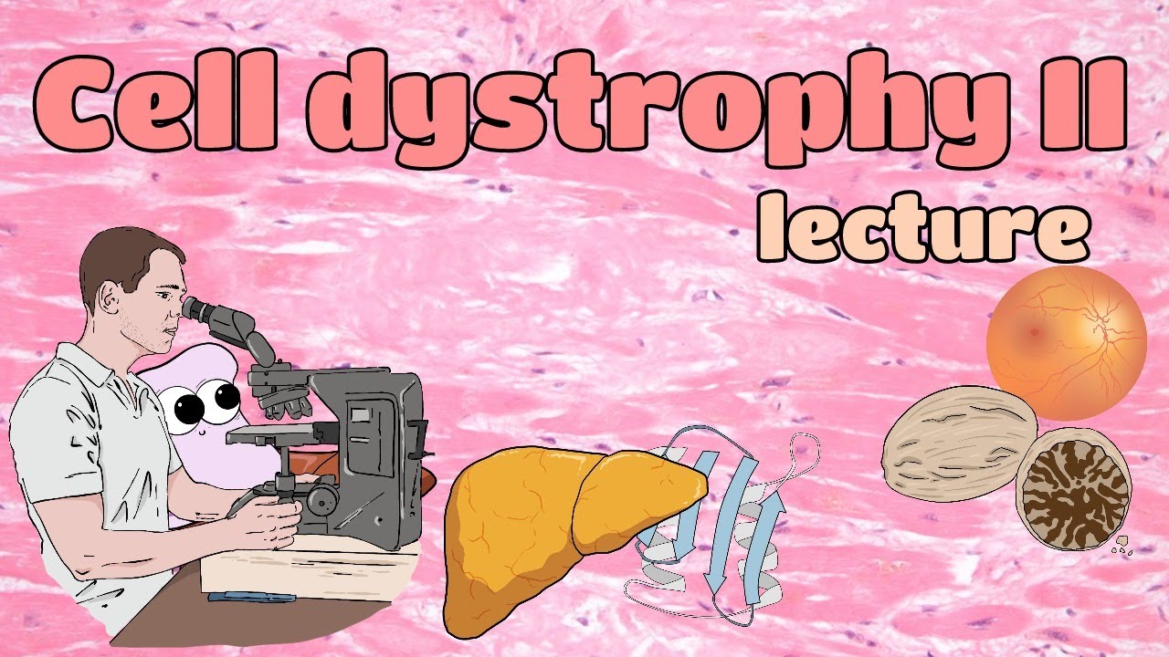 Pathology - Dystrophy of protein, lipid and glycogen metabolism (EN ...