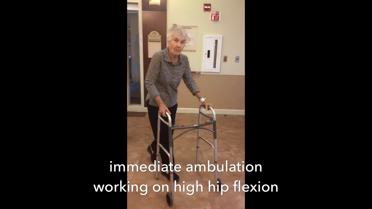 Minimally Invasive Direct Superior Left Hip Replacement Dr Luis A minimally-invasive-direct-superior-left-hip-replacement-dr-luis-a