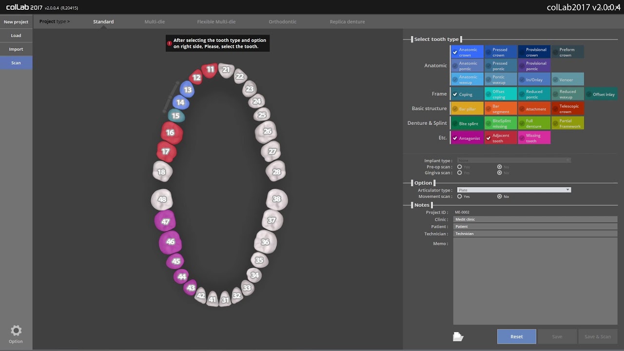 15 Importing cases and loading files - YouTube