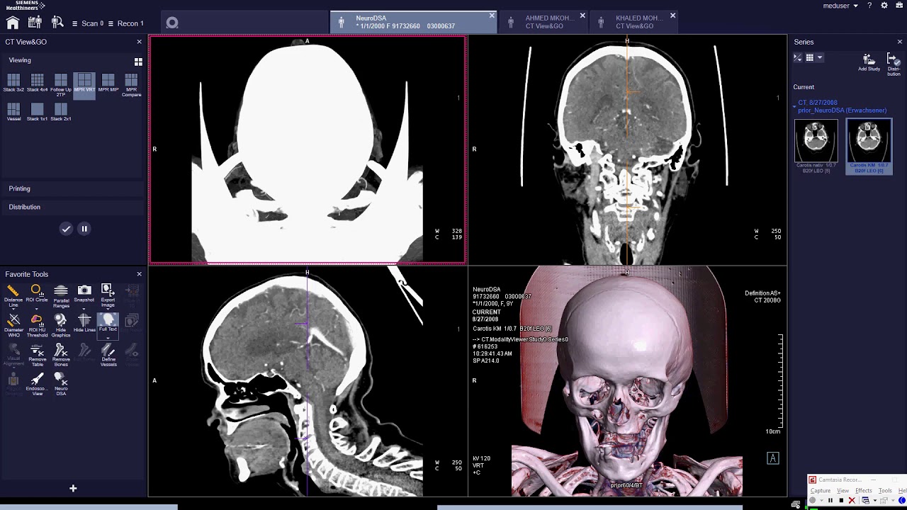 View&Go( 3D card or MPR VRT Layout )- شرح أستخدام الأدوات الموجوده فى ...