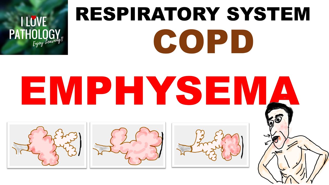 Emphysema Diagnosis Emphysema Diagnosis