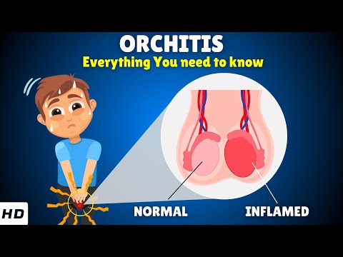 Orchitis – Types, Causes, Signs and Symptoms, Diagnosis & Treatment
