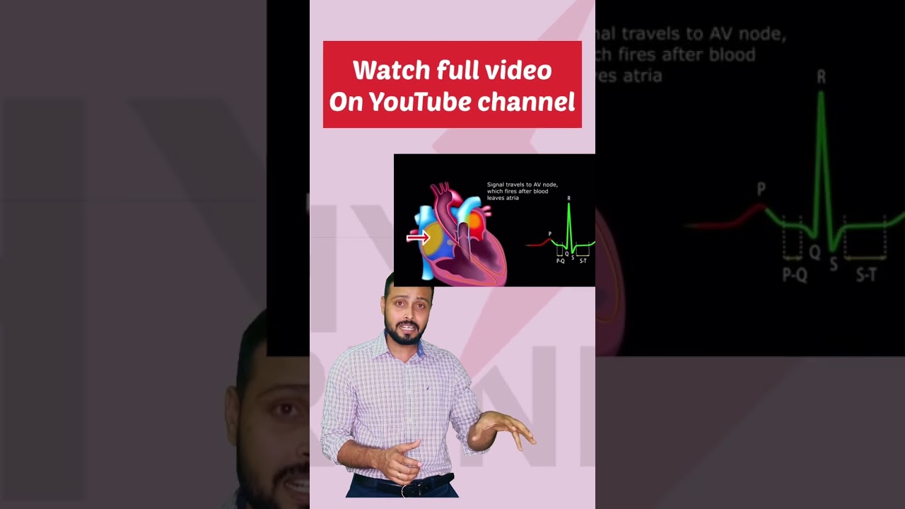 How To Read ECG? Cardiac Health #physiotrendz #medicos #educational ...