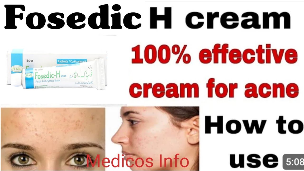 Fosedic h cream uses in urdu|for skin treatment of acne skin ...