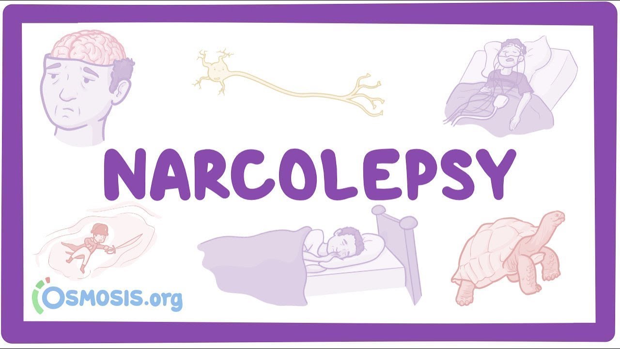 Understanding Narcolepsy: Causes, Symptoms, and Treatment | Sleep ...