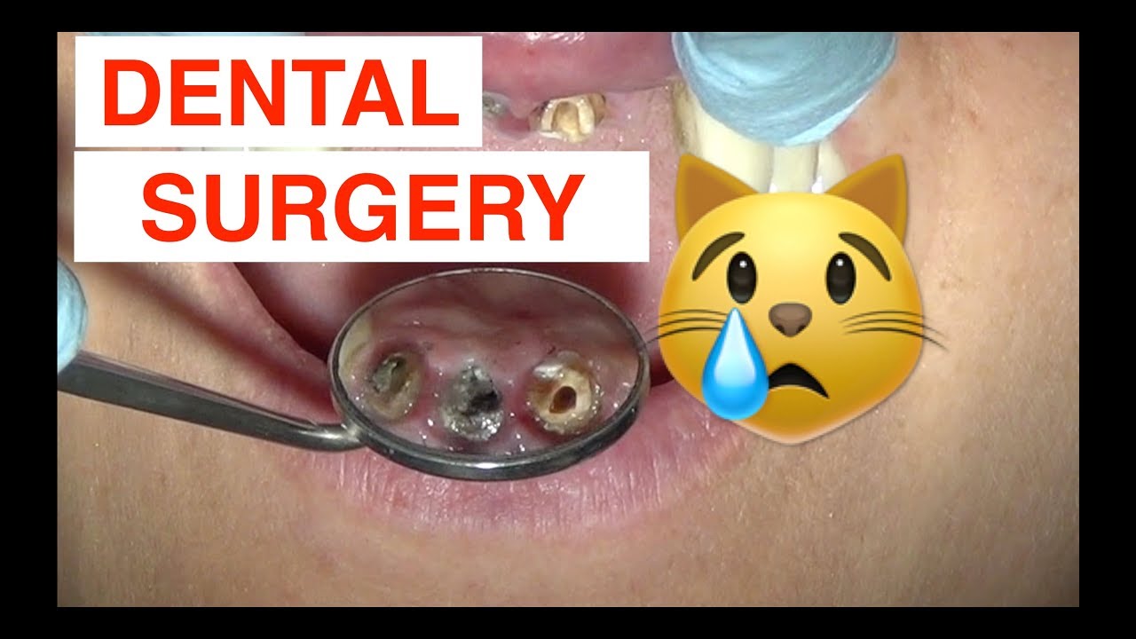 Dental Surgery - YouTube