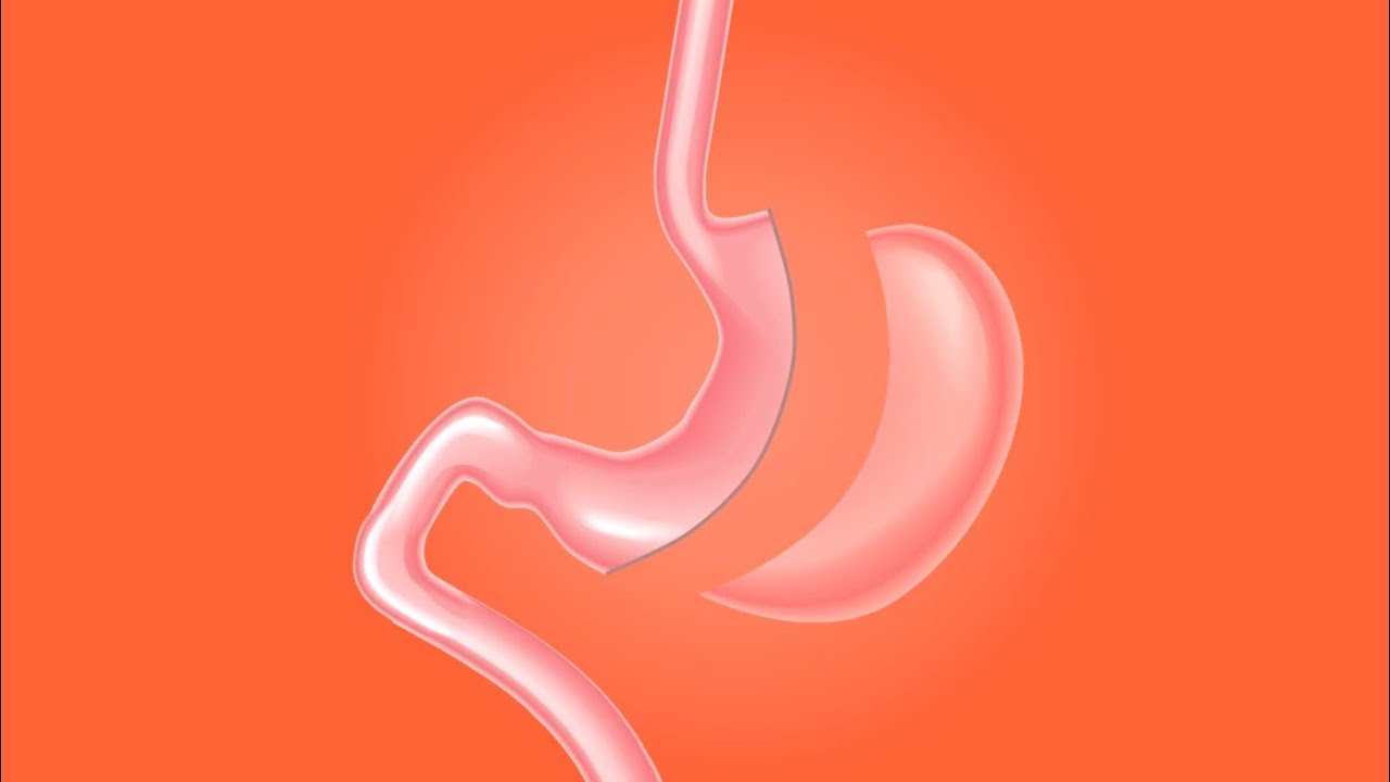 liver by pass surgery Animation l Human body Animation l Animated video ...