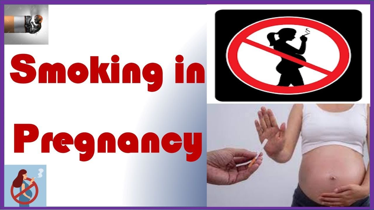 Smoking in Pregnancy | TOG Article - YouTube