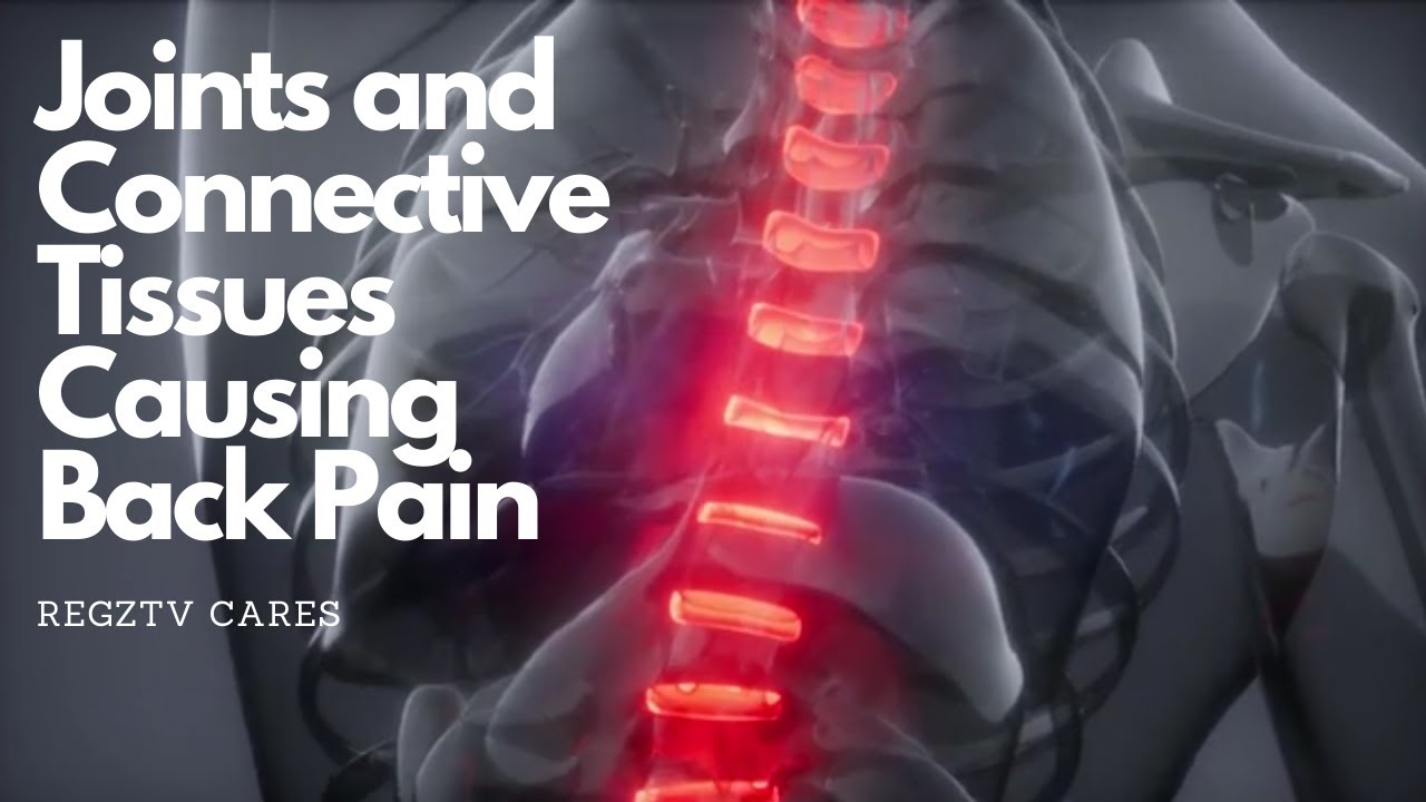 Joints and Connective Tissues Causing Back Pain - YouTube