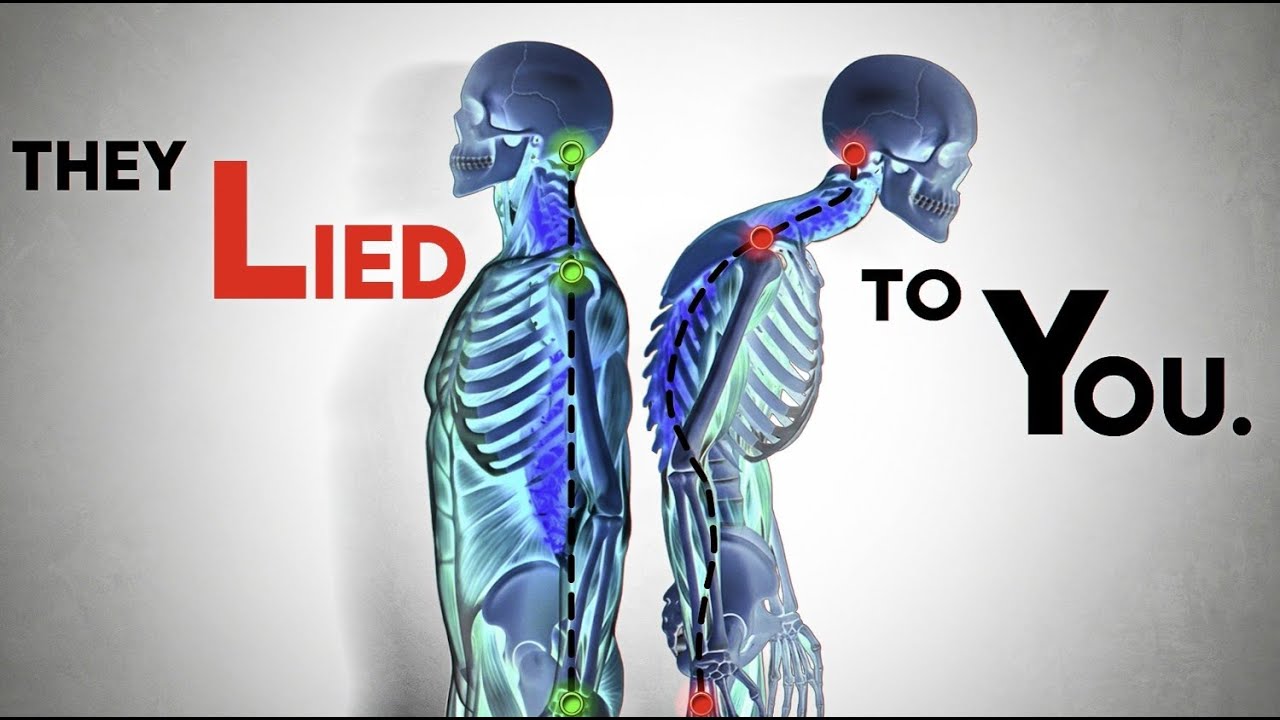 Tight Muscles DON’T Cause Bad Posture - Try This New Fix - YouTube