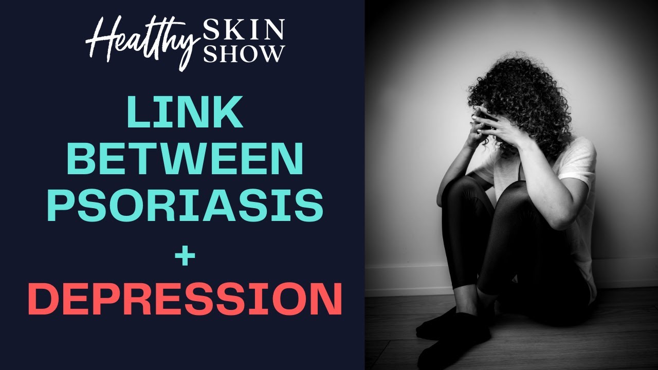 Inflammatory Connection Between Psoriasis + DEPRESSION | Dr. Fabrizio ...