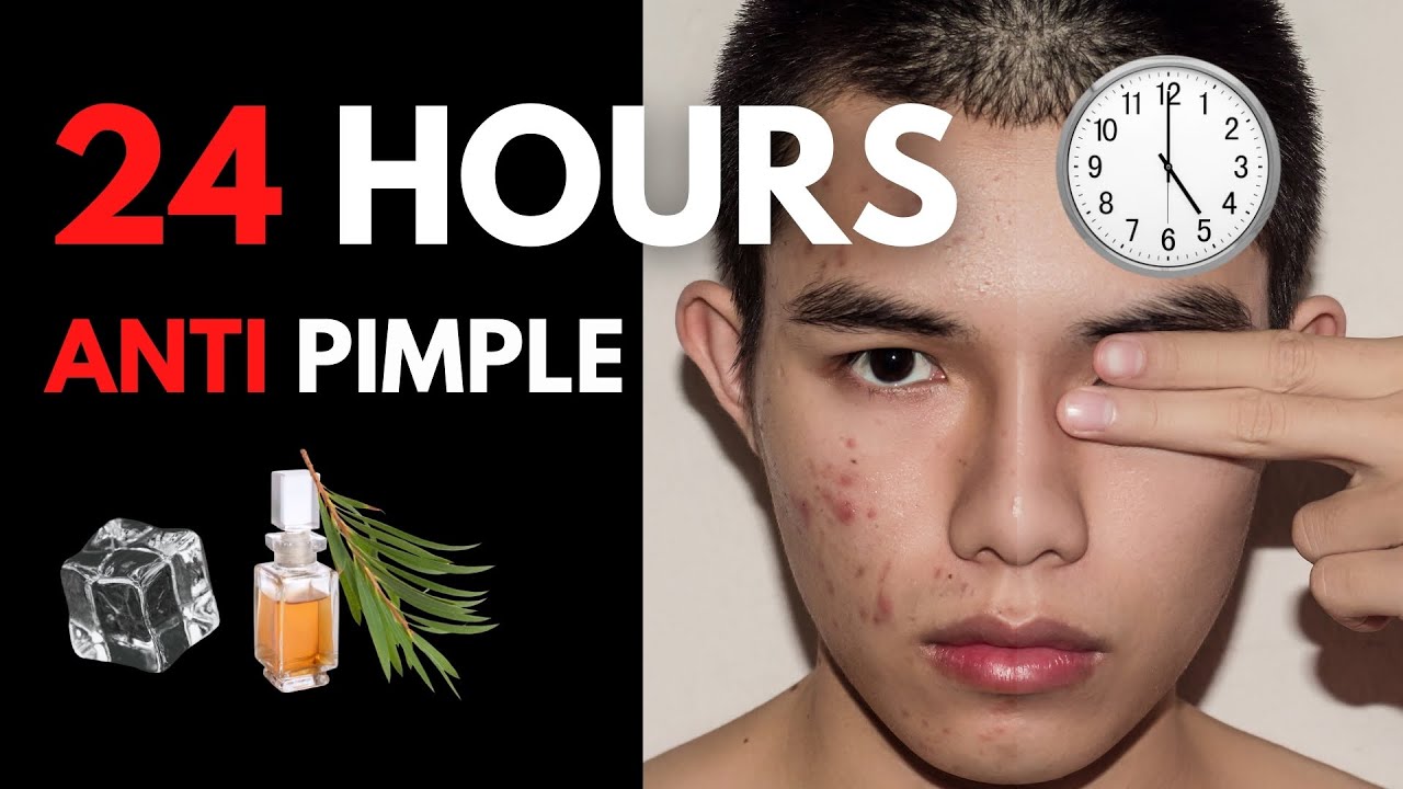 HOW TO GET RID OF A PIMPLE IN 24 HOURS (MEN'S SKIN CARE HACKS) / 7 ...